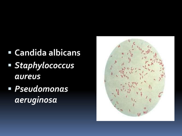 Opportunistic pathogens | PPTX