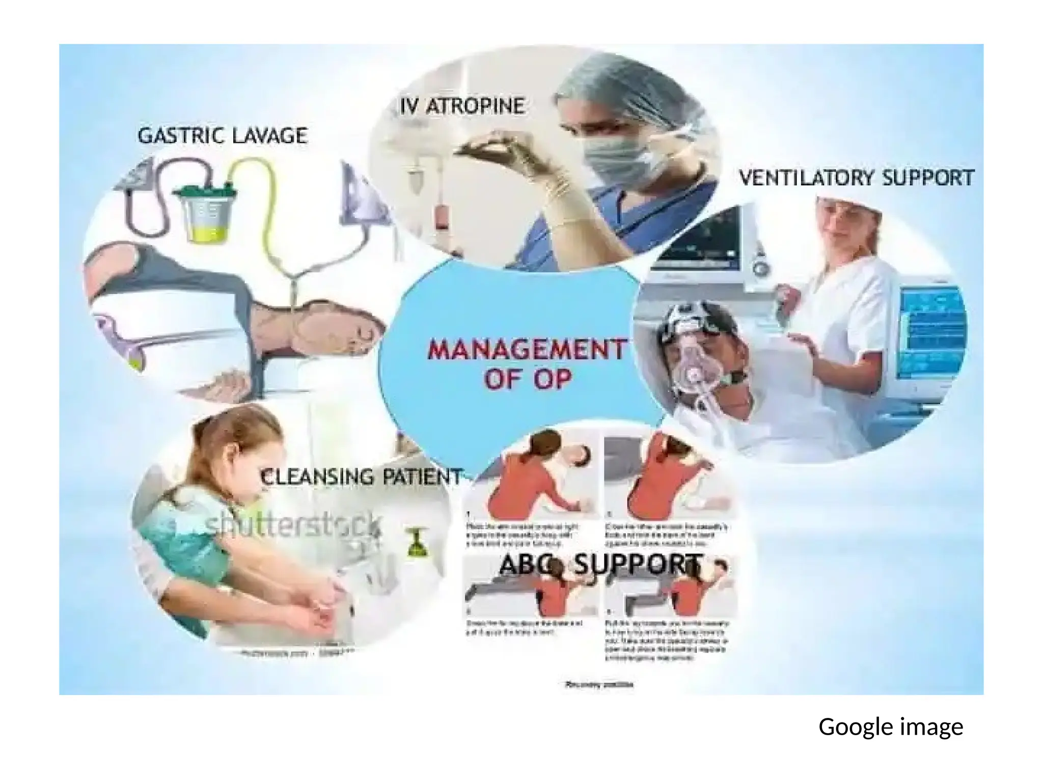 OP Poisoning presentation | PPTX