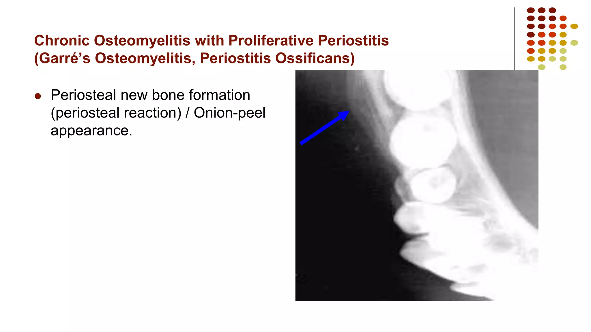 Pulp and periapical disease | PPT