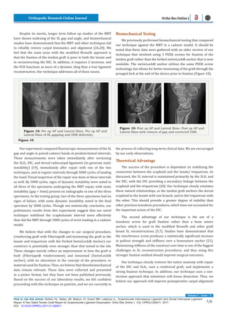 Crimson Publishers-Scapholunate Interosseous Ligament and Dorsal ...