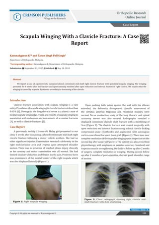 Scapula Winging with a Clavicle Fracture: A Case Report-Crimson ...