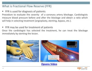 Opsens Presentation | PPTX
