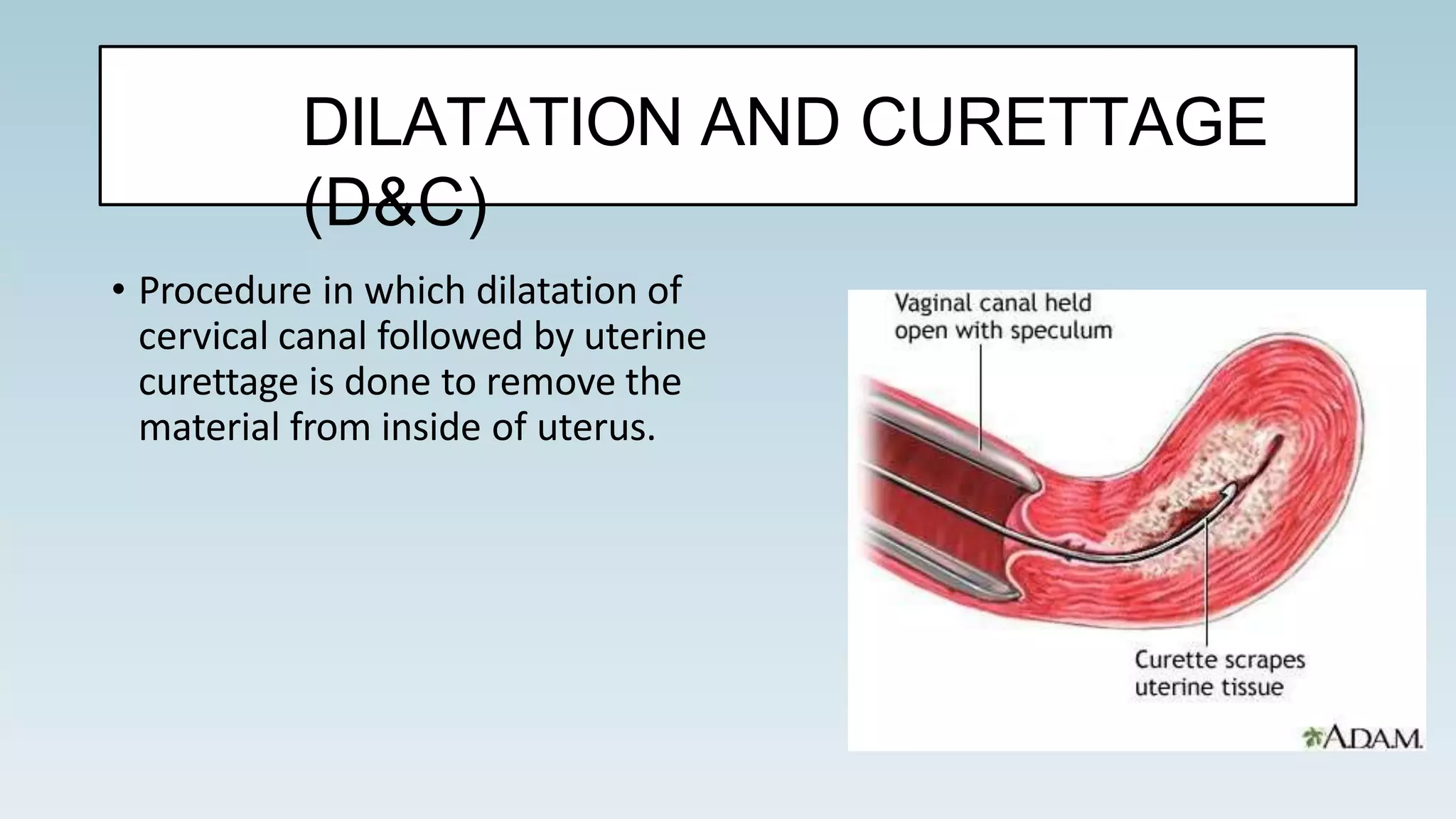 Operative gynaecology | PPTX