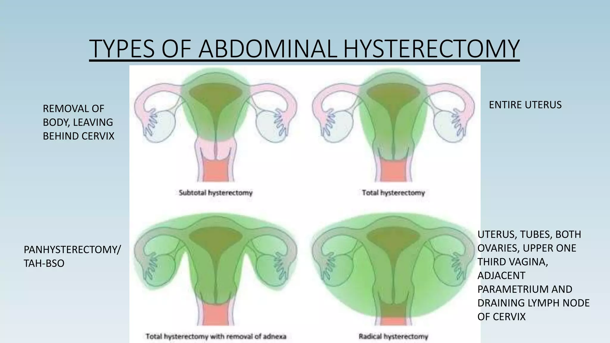 Operative gynaecology | PPTX
