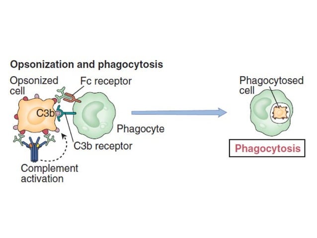 OPSI Splenectomy by Dr. Aryan | PPT