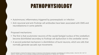 Opsoclonus-Myoclonus Syndrome | PPTX