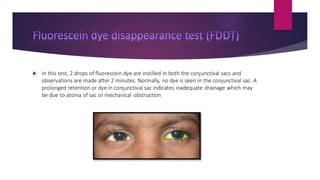 Optha pdf for students specially for mbbs students | PPT