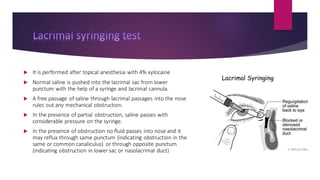 Optha pdf for students specially for mbbs students | PPT