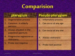 pterygium | PPTX