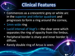 Corneal Degeneration's, Ophthalmology | PPTX