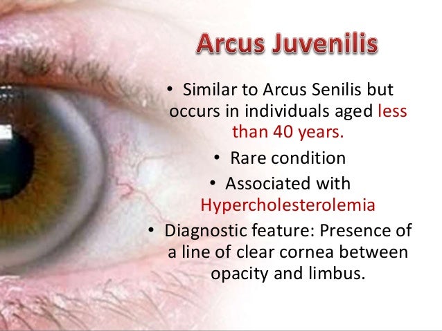 Corneal Degeneration's, Ophthalmology