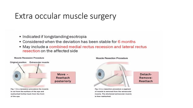 Ophalmology pdf 3,4,6 cranial nerve pdf share | PPT