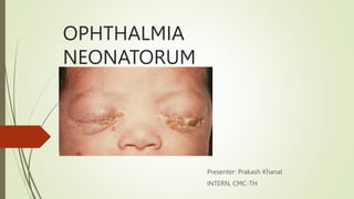OPTHALMIA NEONATORUM.pptx