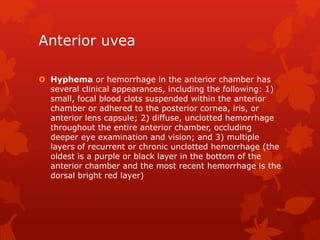 Opthalmic disease | PPTX