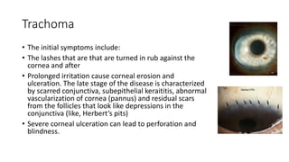 Opthalmic disorders | PPTX