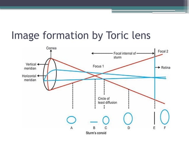 Opthalmic lens power and form presentation.pptx