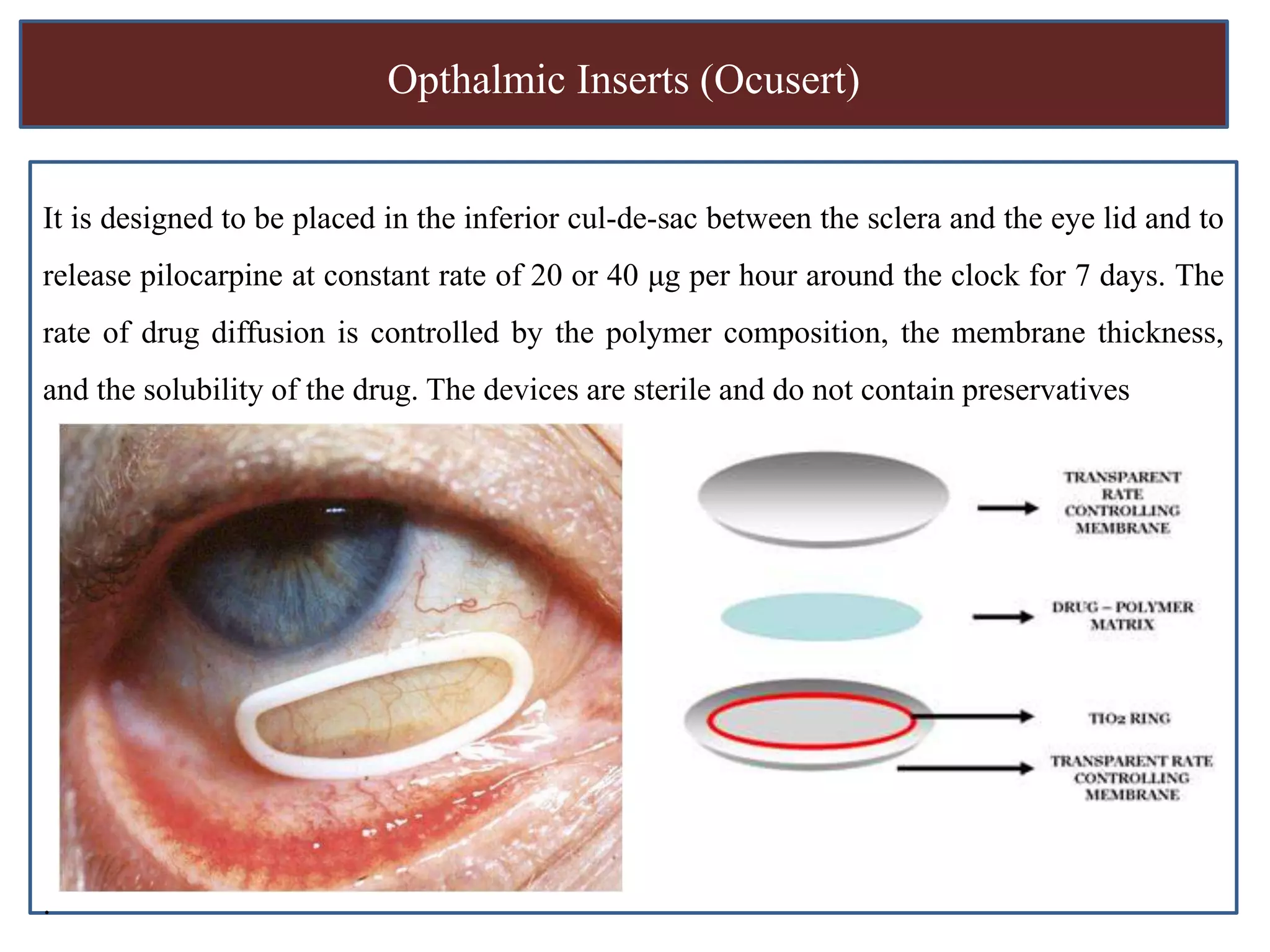 Industrial Pharmacy-I -Ophthalmic preparation part 3 | PPTX