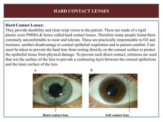 Industrial Pharmacy-I -Ophthalmic preparation part 3 | PPTX