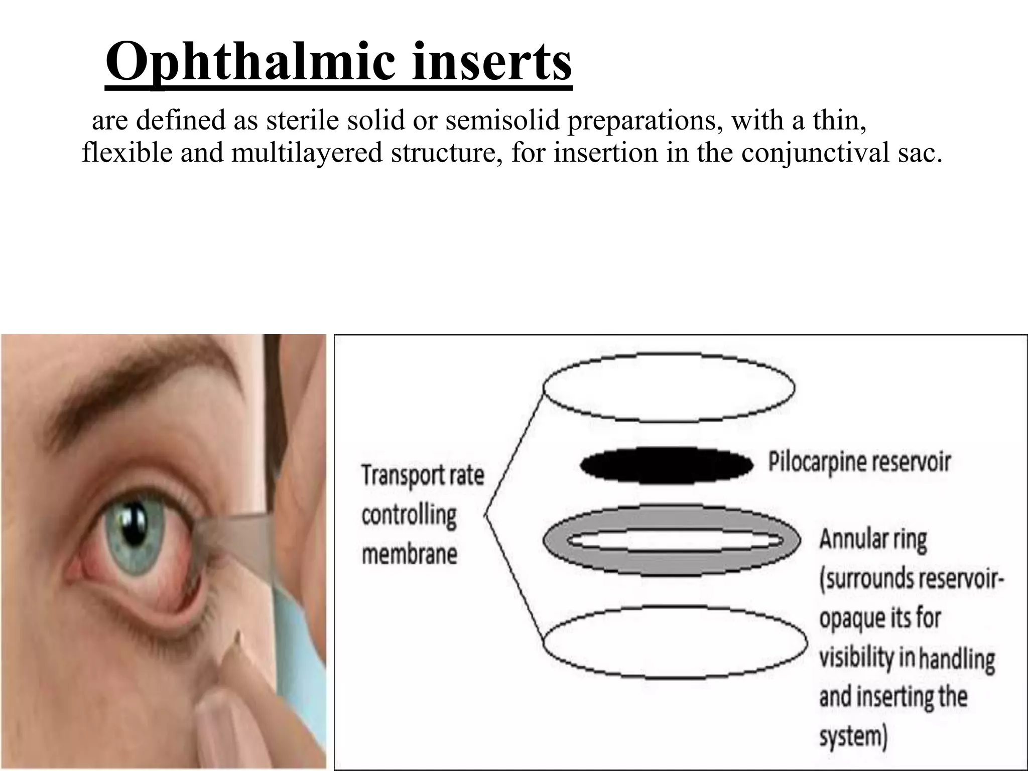 Opthalmic product copy | PPTX