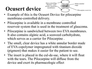 Opthalmic route of administration | PPTX