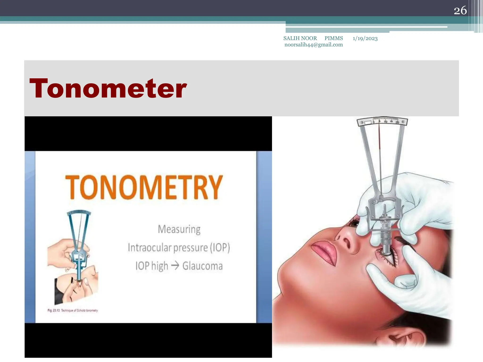 Opthalmic_Surgery.pptx_3_by_SALIH_NOOR.pptx