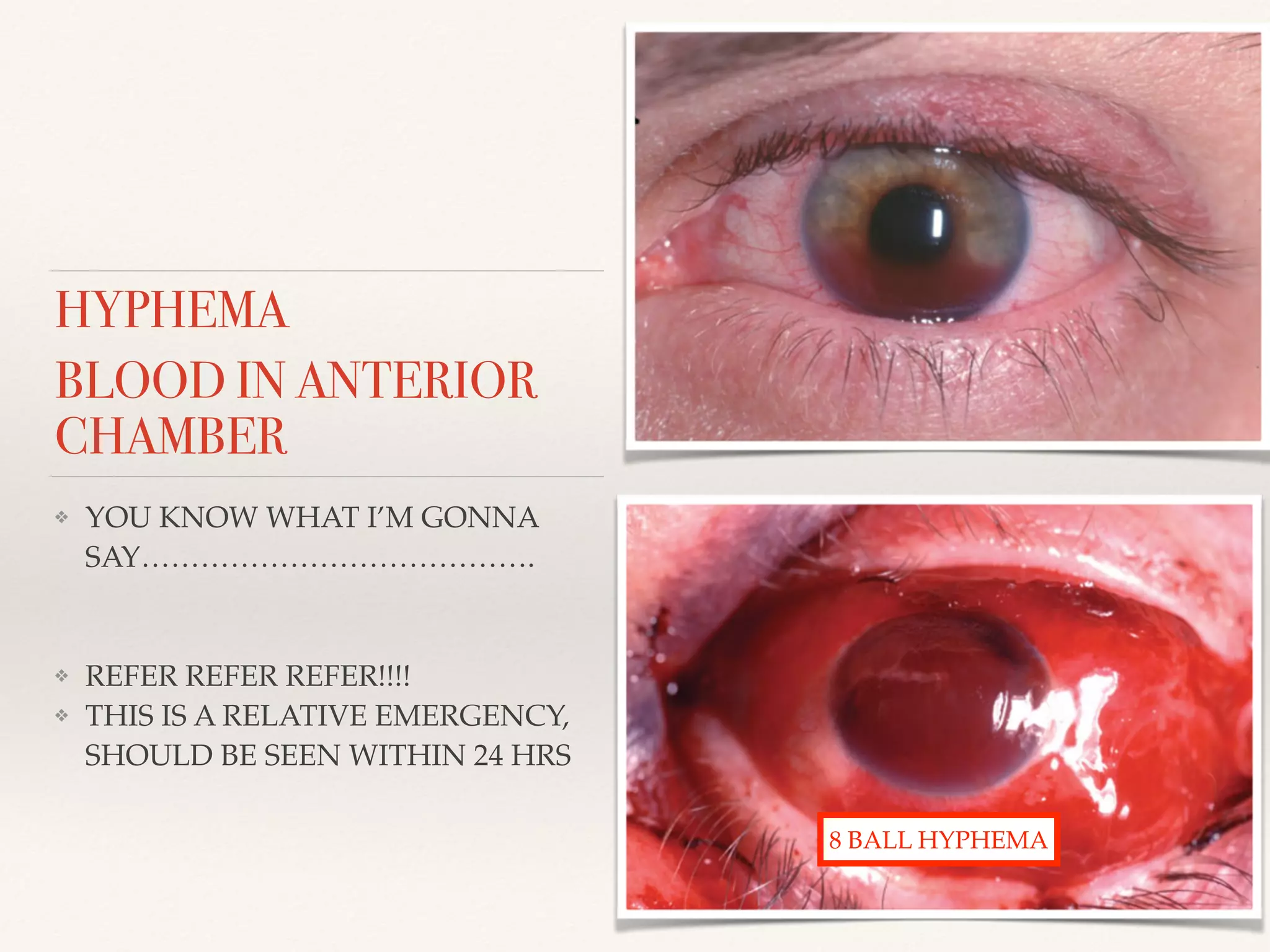 Opthalmic trauma pdf | PDF | Death, Injury, or Military Conflict ...