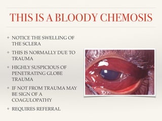 Opthalmic trauma pdf | PPT