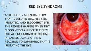 Opthalmology- inflammatory diseases of Eye.pptx