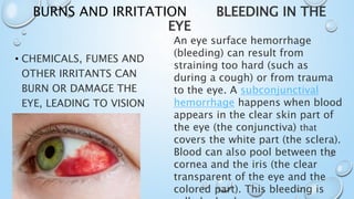 opthalmology - Injuries of organ of vision, eye..pptx