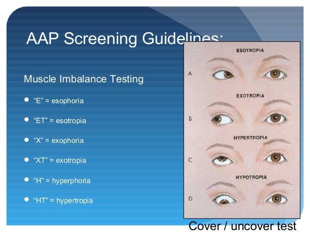 What Is The Difference Between Esotropia And Esophoria