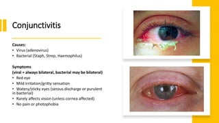 Common eye condition in General Practice | PPTX