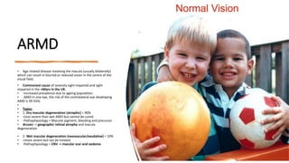 Common eye condition in General Practice | PPTX