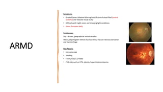 Common eye condition in General Practice | PPTX