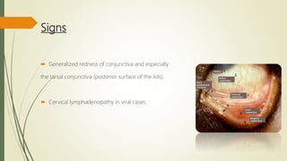 Opthalmology, the red eyes & more on the red eyes | PPT