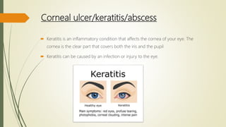 Opthalmology, the red eyes & more on the red eyes | PPT