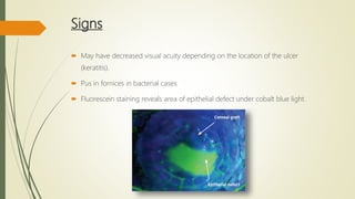 Opthalmology, the red eyes & more on the red eyes | PPT