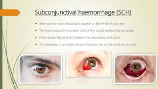 Opthalmology, the red eyes & more on the red eyes | PPT