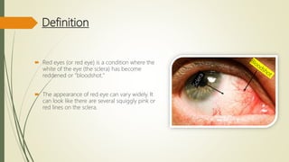 Opthalmology, the red eyes & more on the red eyes | PPT