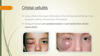 Opthalmology, the red eyes & more on the red eyes | PPT