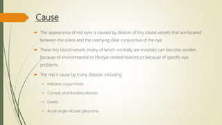 Opthalmology, the red eyes & more on the red eyes | PPT