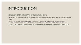 herpes simplex keratitis.pptx