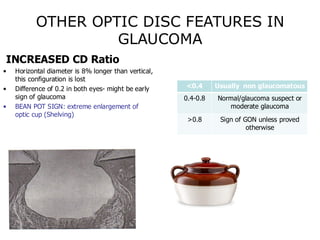 Optic Disc Evaluation in glaucoma and its applied | PDF