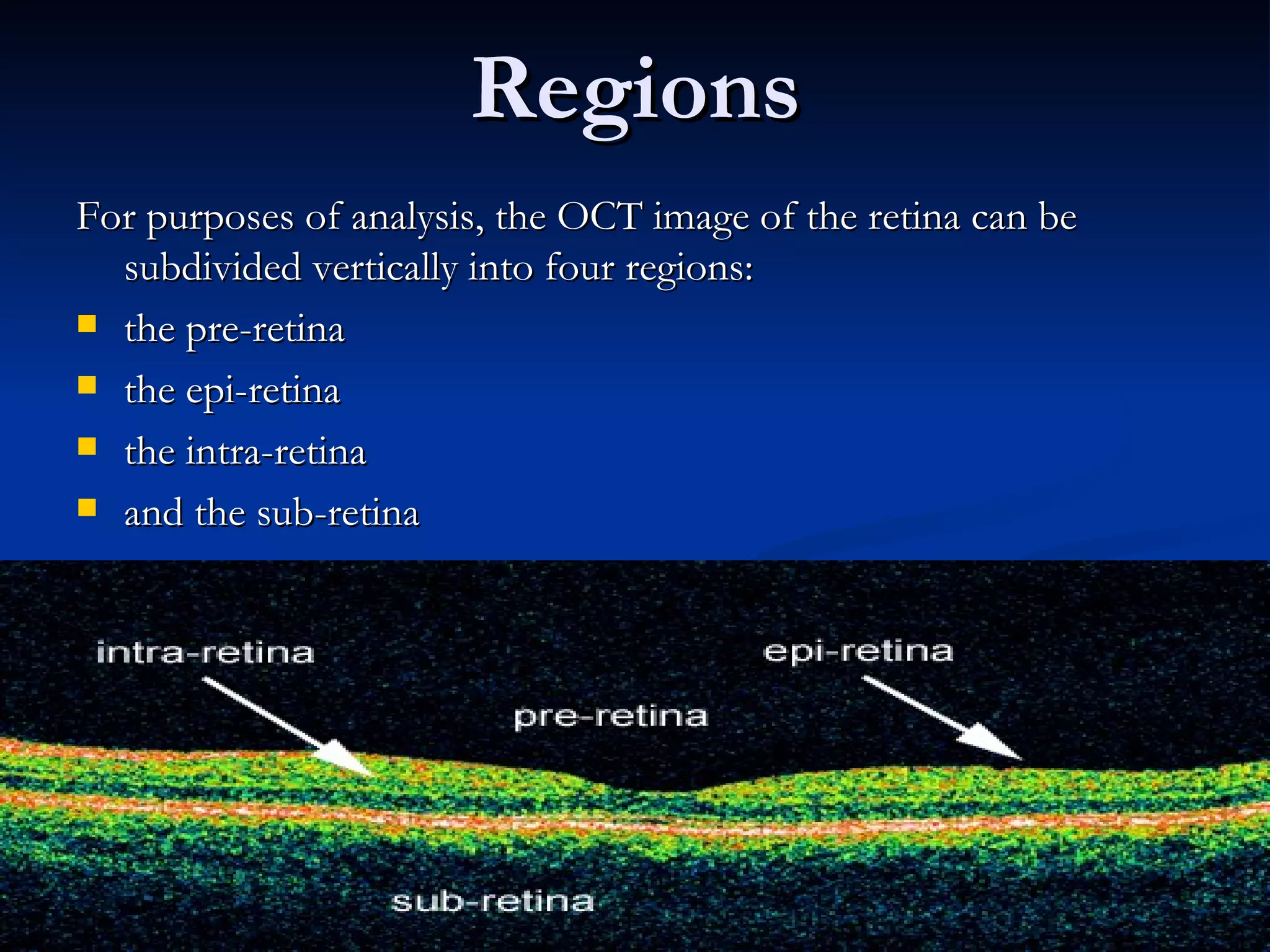 Optical Coherence Tomography - principle and uses in ophthalmology | PPT