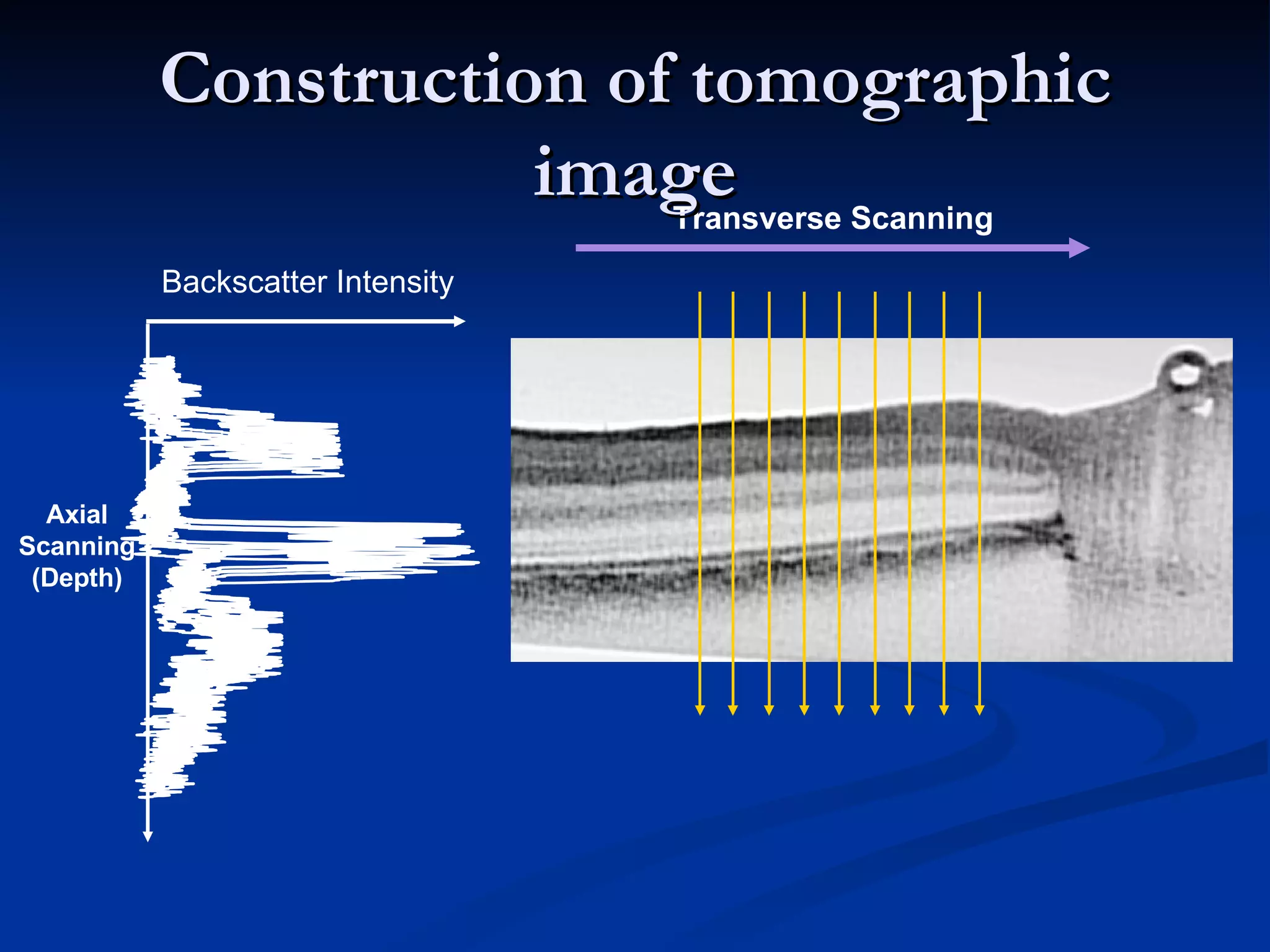 Optical Coherence Tomography - principle and uses in ophthalmology | PPT