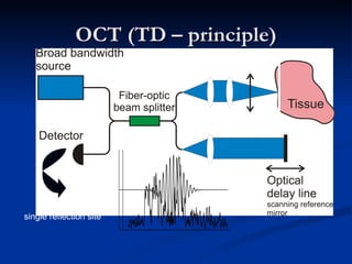 Optical Coherence Tomography - principle and uses in ophthalmology | PPT