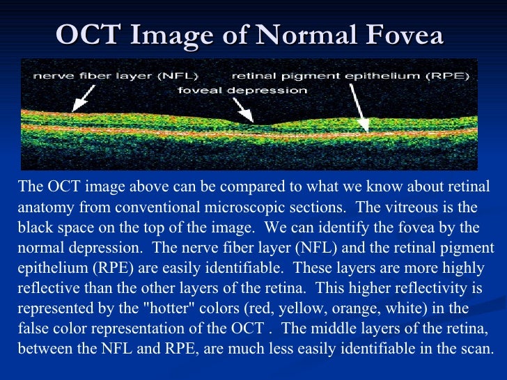 Optical Coherence Tomography - principle and uses in ophthalmology