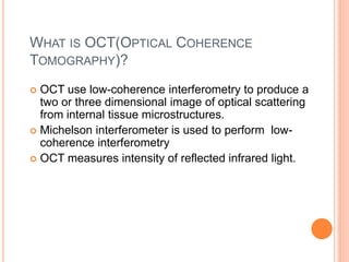 optical-coherence-tomography-8889-l2YBJiS.pptx