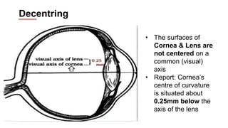 OPTICAL ABERRATIONS OF THE NORMAL EYE by Anuska Chakraborty.pptx
