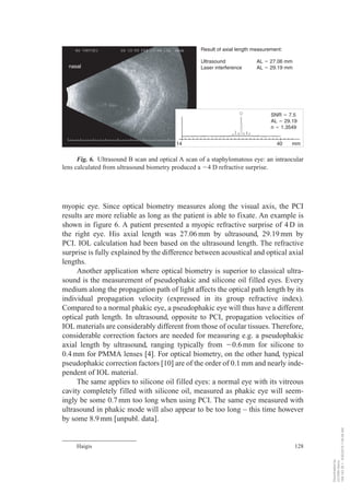 Optical coherence biometry | PDF