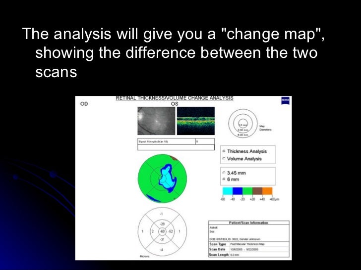 Optical coherence tomography information phase - studiolasoo